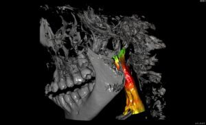 Quickvision 3D - Logiciel de planification implantaire - Owandy Radiology